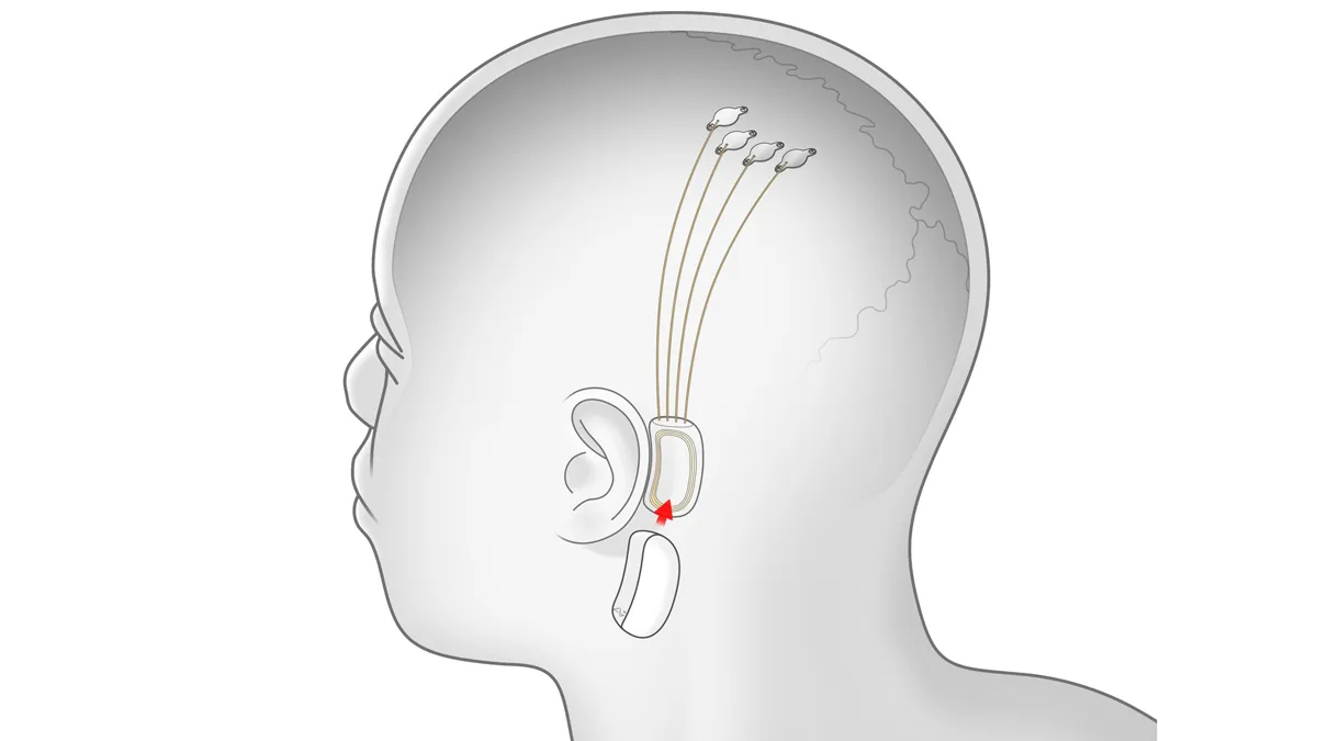 Elon Musk to Demo Neuralink Device on Friday